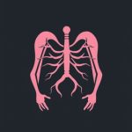 What Is The Most Common Etiological Agent Of Gangrene? – Icfplivestock.com